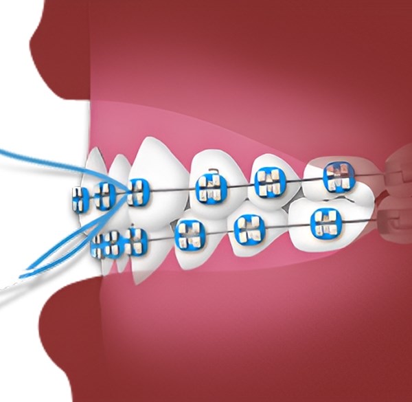 Oral Hygiene | David Crowder, D.D.S. | Bartlett TN
